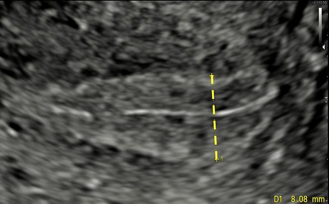 Ultrasound Assessment of Pelvic Anatomy | Article | GLOWM